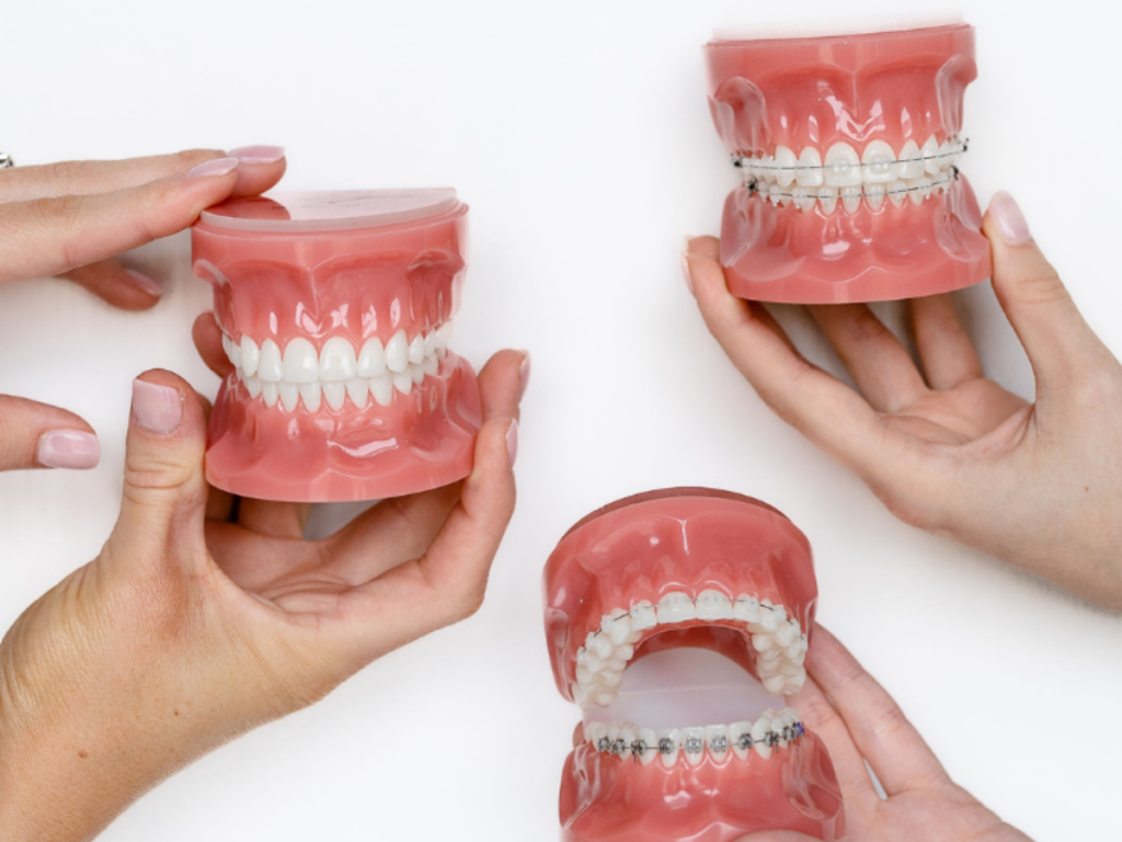 Can Invisalign Fix an Overbite? — Kunik Orthodontics