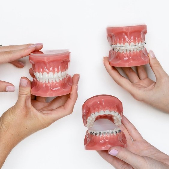 Kunik Orthodontics: Best Invisalign Dentist in Austin, TX